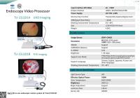 China TU-15LSD1B  1080P 15.6 Inch  Endoscope Camera With Record  For ENT Laparoscopy Hysteroscopy Urology for sale