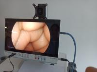 China TU-15LSD1B  1080P 15.6 Inch  Endoscope Camera With Record  For ENT Laparoscopy Hysteroscopy Urology for sale