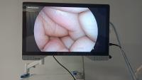 China 27 Inch FHD Medical Endoscope Camera with 8 Hour Battery Life for sale