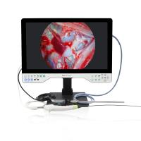 China TUYOU TU-24LSDB All in One Medical Endoscopy Camera with SONY CMOS Sensor Metal and Plastic Material Freeze Digital Zoom White Balance Function for sale
