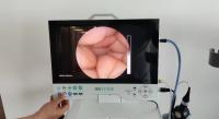 China TUYOU TU-24LSDB All in One Medical Endoscopy Camera with SONY CMOS Sensor Metal and Plastic Material Freeze Digital Zoom White Balance Function for sale