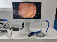 China 15'' All-in-One Full HD Endoscopy Camera System with Built-in LED Light Source for ENT and Urological Surgical Applications for sale