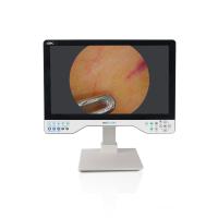 China New 24inch FHD/4K TUYOU All-in-one Medical Endoscope Camera for ENT Laparoscopy Surgery for sale
