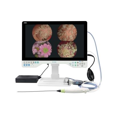 China Factory Direct Price 1080P Medical Endoscope Camera System with Dual-Mode Endoscope Support and High-Intensity Light Source for Multi-Department Use for sale