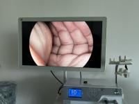 China FHD Medical Endoscope Camera System with SONY CMOS Sensor Built-in Video Recording and One-touch Freeze for sale