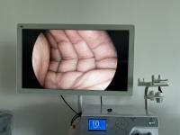 China FHD Medical Endoscope Camera System with SONY CMOS Sensor Built-in Video Recording and One-touch Freeze for sale