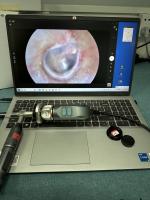 China TU-FHD USB2.0  FHD Medical Endoscope Camera with SONY CMOS Sensor and Auto White Balance for sale