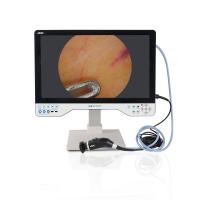 China Manufacturer Direct 24 Inches 1080P All-in-one Camera System For Laparoscopy Surgery ENT Checking for sale