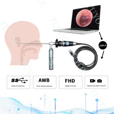 China China Manufacturer FHD USB3.0 Endoscope Camera For ENT Checking On Laptop for sale