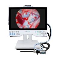 China Hot Sale 15.6'' All-in-one Medical Endoscope Camera System With Light For ENT Cystoscopic Surgery for sale