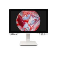 China Medical Grade TUYOU 27 Inch All-in-One Endoscopic Camera - FHD/4K for ENT Laparoscopic Procedures for sale