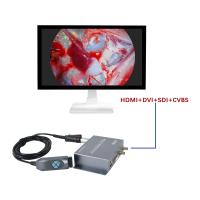 China Affordable 1080P Full HD Portable Endoscopic Camera System - OEM Available for Office/Clinic Examinations for sale