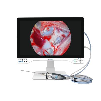 China 32inch All-in-One Portable Endoscope Camera System Professional Medical Devices With 4K Monitor And Light Source for sale
