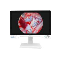 China 32inch All-in-One Portable Endoscope Camera System Professional Medical Devices With 4K Monitor And Light Source for sale
