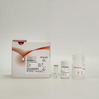 China Clinic Lab PCT Test Kit Procalcitonin Reagent 50 Tests / Kit for sale