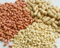 China 5 Chutes Optical Color Sorter 320 Channels For Pulses Sorting for sale