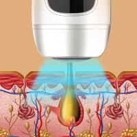 China Freezing Point Laser IPL Hair Removal Epilator 990000 Flashes Home Use Portable Ice Cool Painless Hair Remove Device Dep for sale