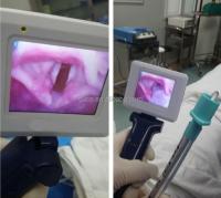 China Portable video laryngoscope with 3pcs reusable blade for sale