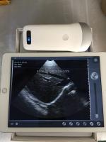 China Wireless ultrasound probe iphone ultrasound probe uprobe-2(Convex) with ISO and CE for sale