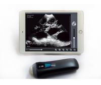 China Laptop color Doppler ultrasound system Uprobe-1 for sale