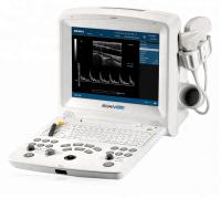China DUS 60 new compact ultrasound system for sale