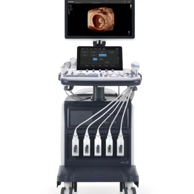 China Sonoscape S60 Ecografo Sonoscape Ultrasound Machine Cw Tdi Software For Free for sale