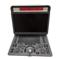 China CW TDI software Sonoscape cardiac color doppler  Sonoscape E2  E3 ultrasound for sale