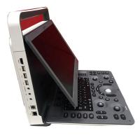 China CW TDI software Sonoscape cardiac color doppler  Sonoscape E2  E3 ultrasound for sale