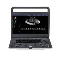 China CW TDI software Sonoscape cardiac color doppler  Sonoscape E2  E3 ultrasound for sale