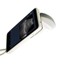 China Handheld Ultrasound Scanner convex transducer for sale