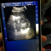 China Handheld Ultrasound Scanner convex transducer for sale