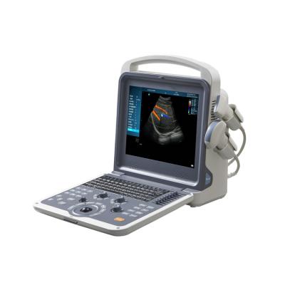 China Factory price color doppler portable ultrasound scanner for sale