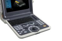 China Factory price color doppler portable ultrasound scanner for sale