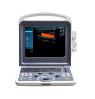 China Factory price color doppler portable ultrasound scanner for sale