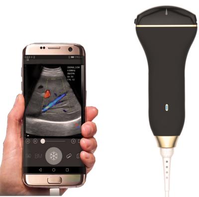China Mobile Smart USB Color Doppler Ultrasound Probe For Laptop for sale