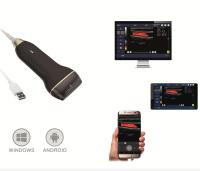 China Mobile Smart USB Color Doppler Ultrasound Probe For Laptop for sale