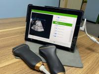 China Mobile Smart USB Color Doppler Ultrasound Probe For Laptop for sale