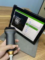 China Mobile Smart USB Color Doppler Ultrasound Probe For Laptop for sale