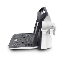 China Portable Full Digital Color Doppler Ultrasound System Medical Scanner Ultrasound for sale
