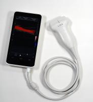 China Ultrasound Scanner 6 inch 128 Elements Handheld Touch Screen Color Doppler Machine with convex/linear probe for sale
