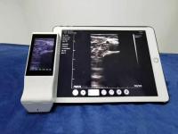 China Portable wireless 7.5mhz linear doppler ultrasound probe for sale