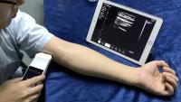 China Portable wireless 7.5mhz linear doppler ultrasound probe for sale