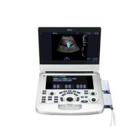 China Color Ultrasound Machine Obstetrics And Gynecology Equipment 17MHz Linear Probe for sale