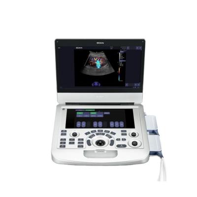 China Color Ultrasound Machine Obstetrics And Gynecology Equipment 17MHz Linear Probe for sale