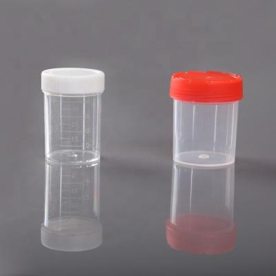 China Good Quality Disposable Urine Container/ Urine Cup 30ml, 40ml, 60ml, 120ml for sale