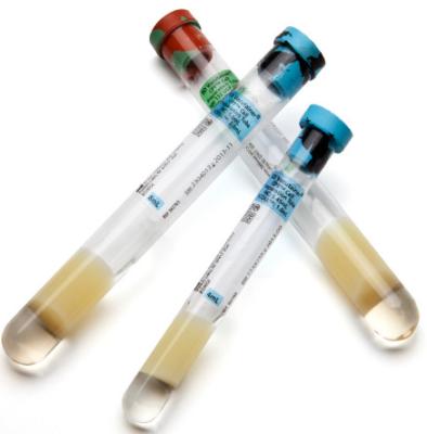 China Prp Tube Platelet Rich Plasma 10ml 15ml Disposable Medical Consumables CE for sale