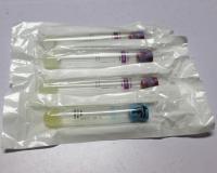 China Prp Tube Platelet Rich Plasma 10ml 15ml Disposable Medical Consumables CE for sale