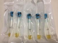 China Prp Tube Platelet Rich Plasma 10ml 15ml Disposable Medical Consumables CE for sale