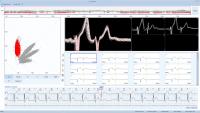 China Digital Twelve Channels  ECG Holter 24 Hours ECG Data Record Standard Electrocardiogram HT06 for sale