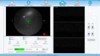 China Professional Optical machine/ OCT  with fundus camera function  Optical Coherence Tomography for sale
